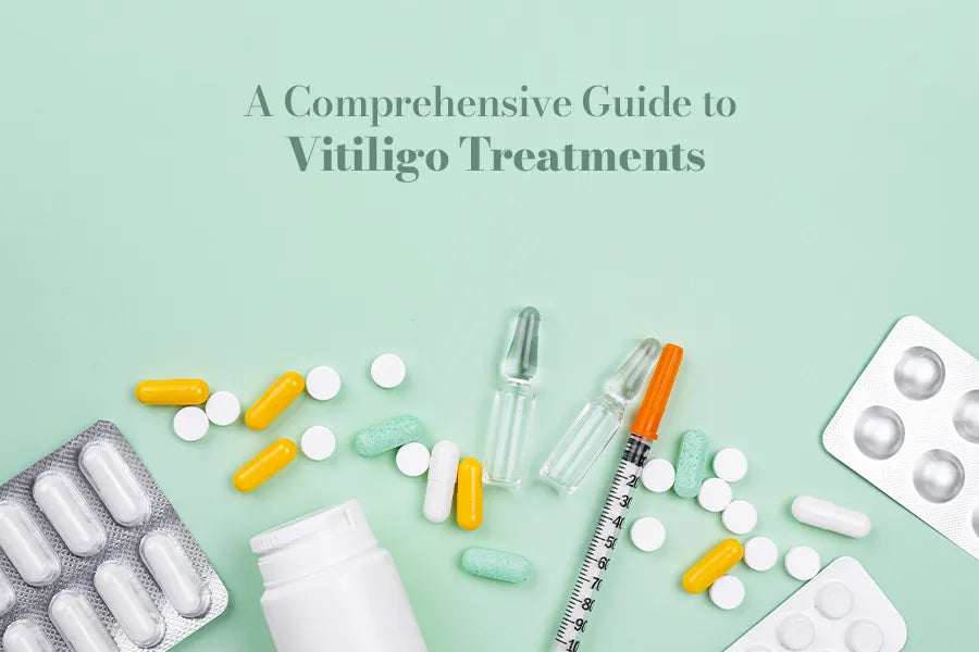 A Comprehensive Guide To Vitiligo Treatment